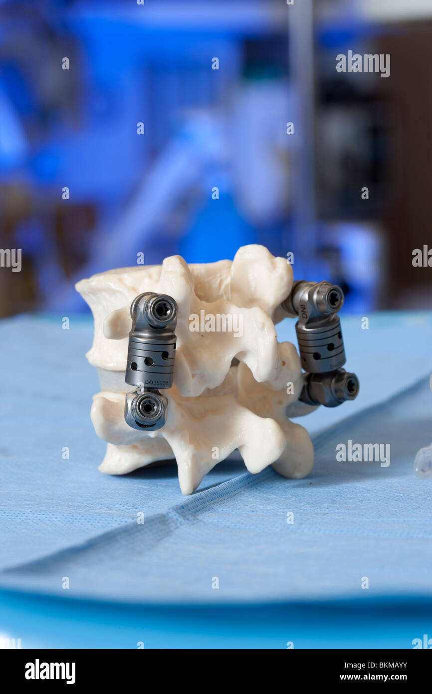 Medical parts used in spine surgery for disc replacement and other ...