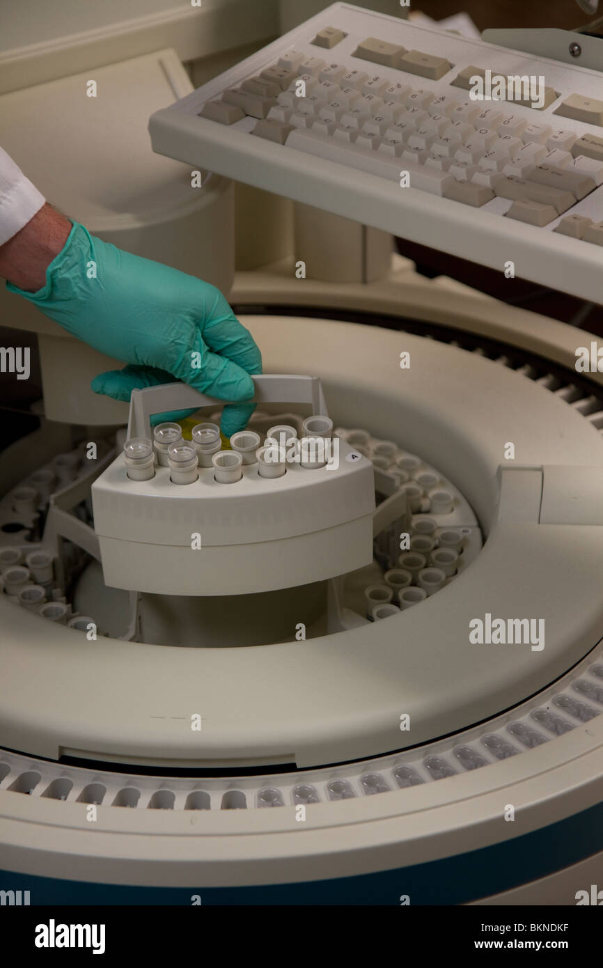 Immunoassay hi-res stock photography and images - Alamy