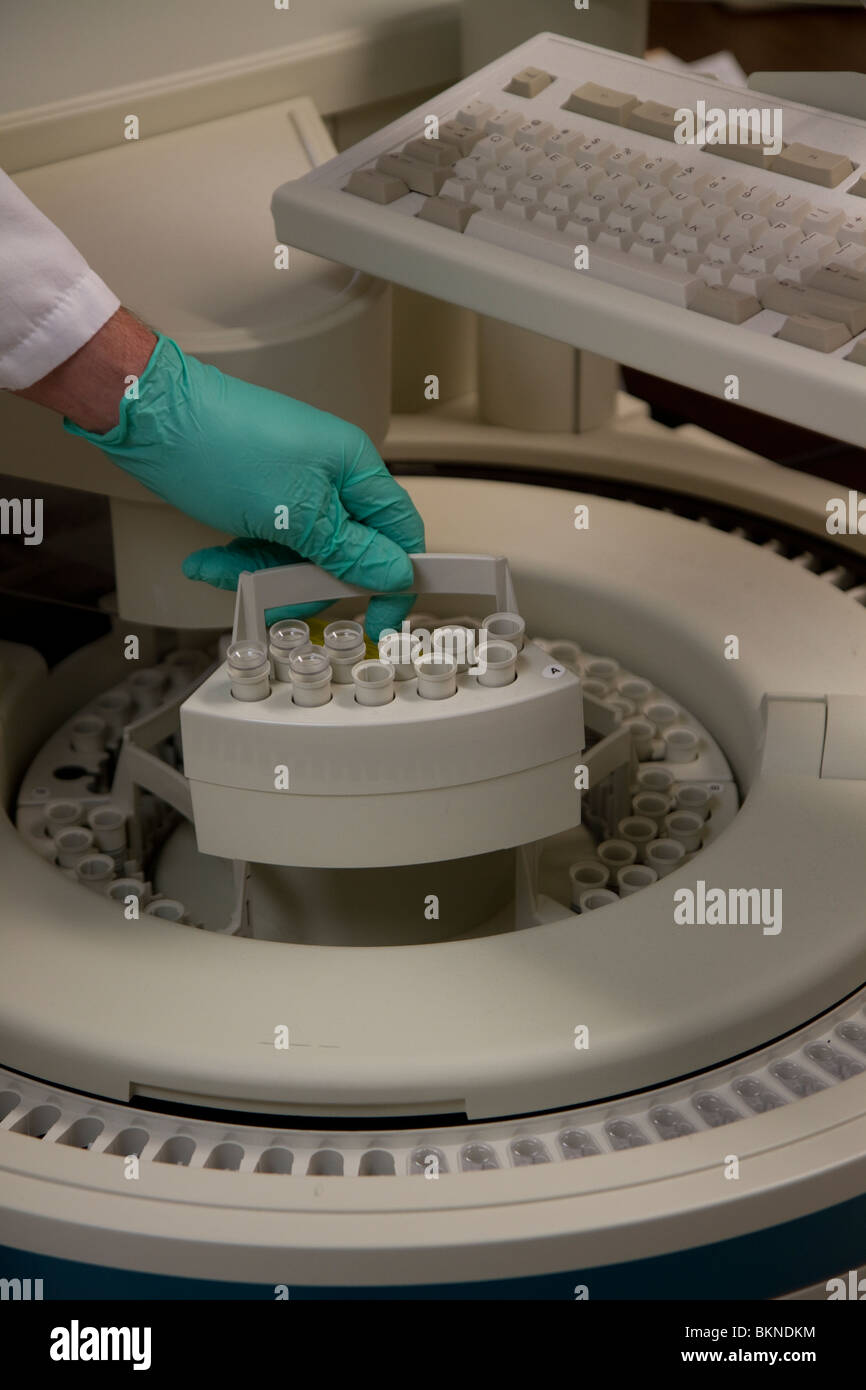 Abbott AxSym, an immunoassay system that is used for serology testing ...