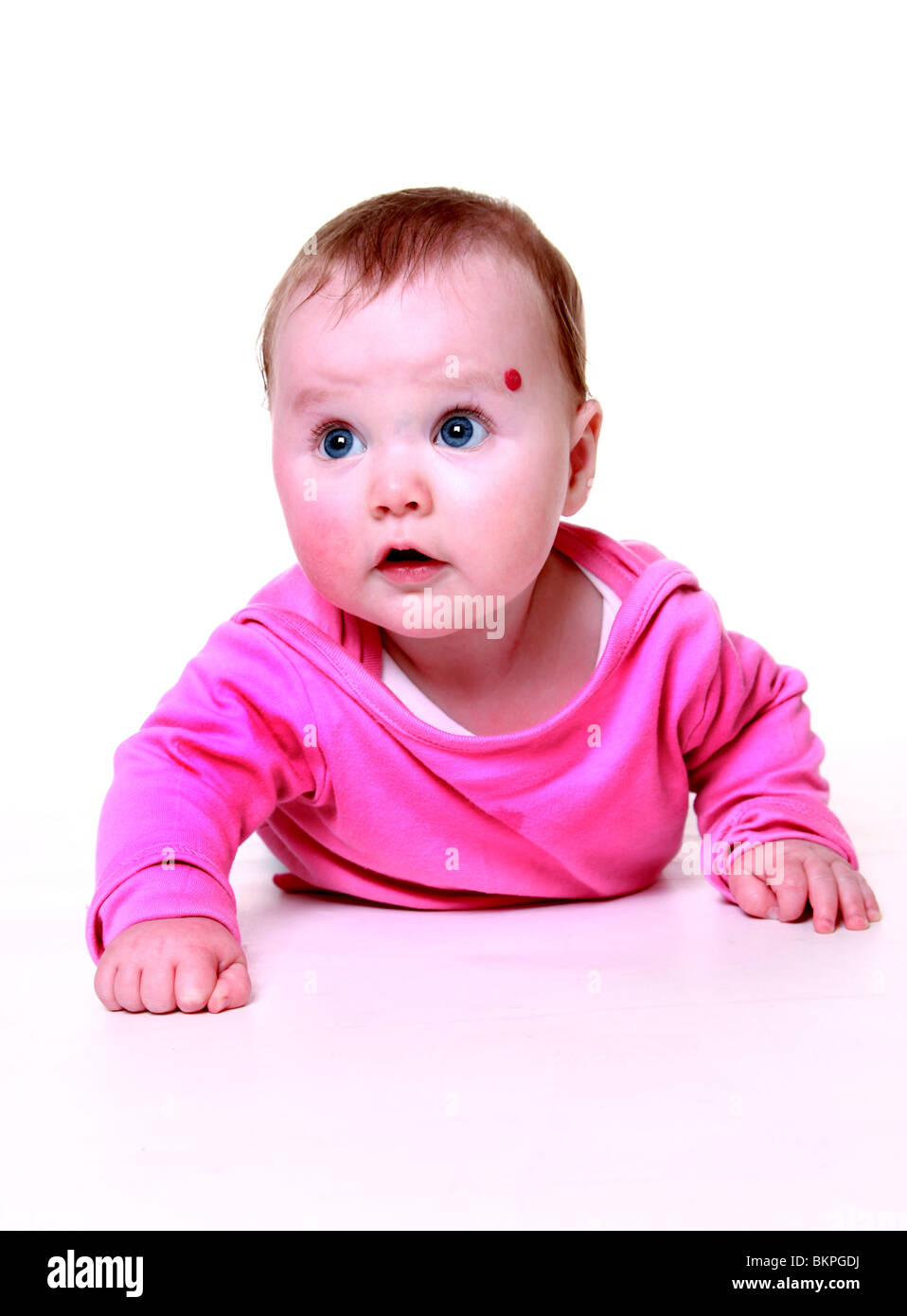 Strawberry naevus child hi-res stock photography and images - Alamy