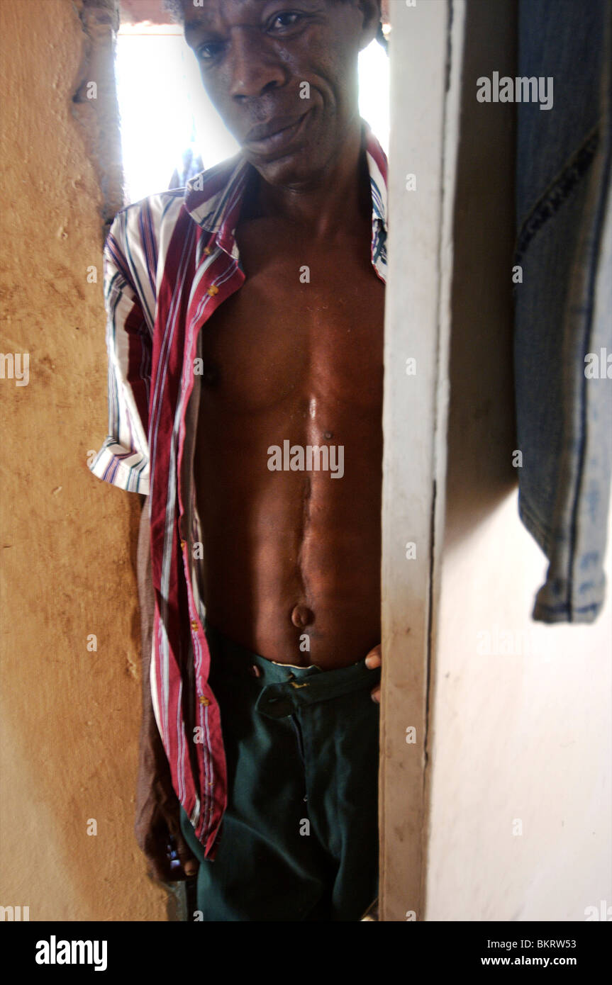 Stomach cut open High Resolution Stock Photography and Images - Alamy