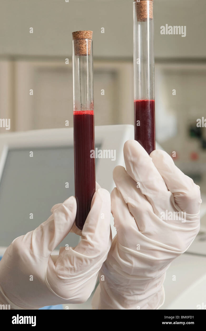 Lab technician holding blood samples in a test tube Stock Photo - Alamy