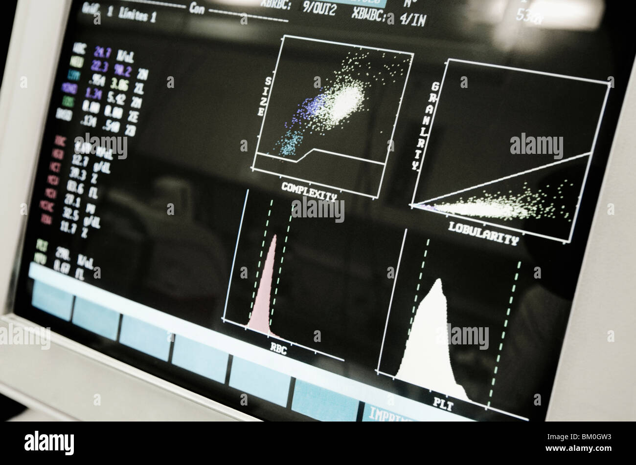 Hematology analyzer hi-res stock photography and images - Alamy