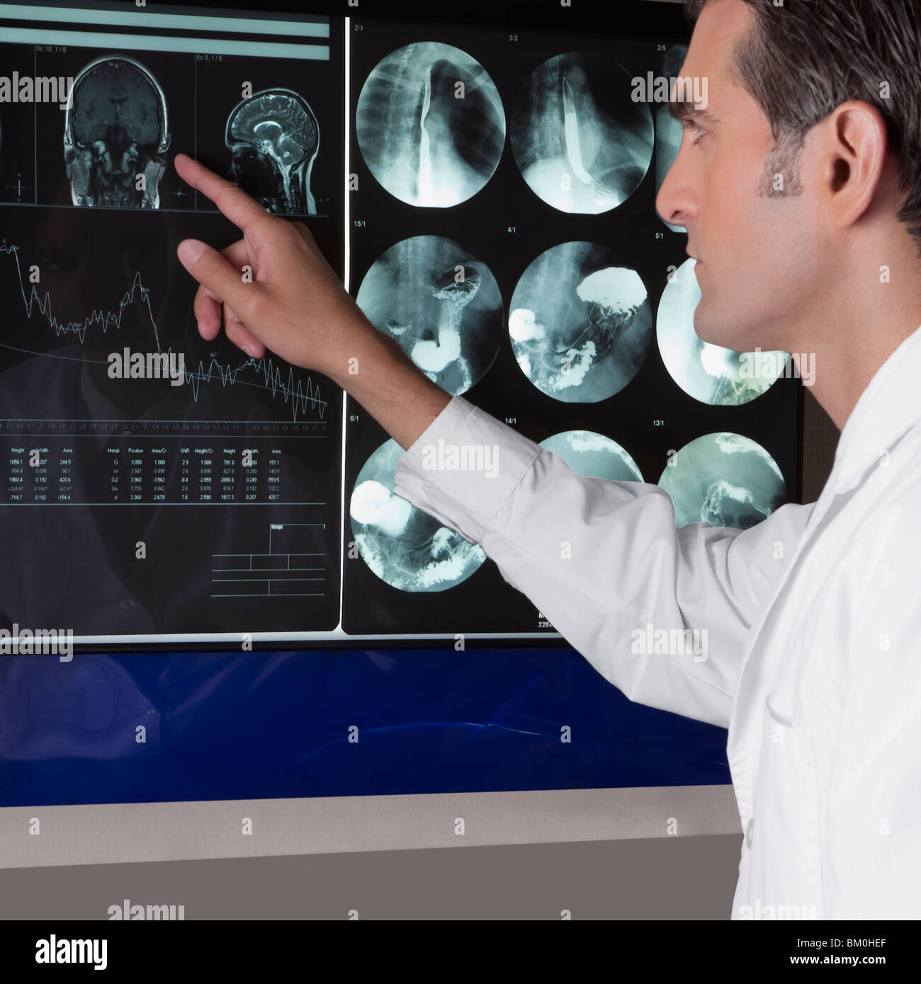 Mri Report High Resolution Stock Photography and Images - Alamy