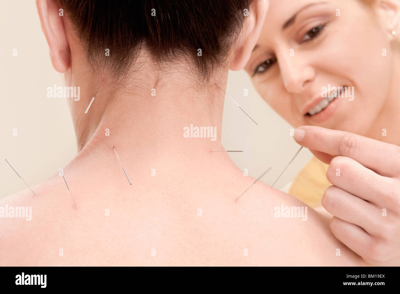 Applying acupuncture on skin hi-res stock photography and images - Alamy
