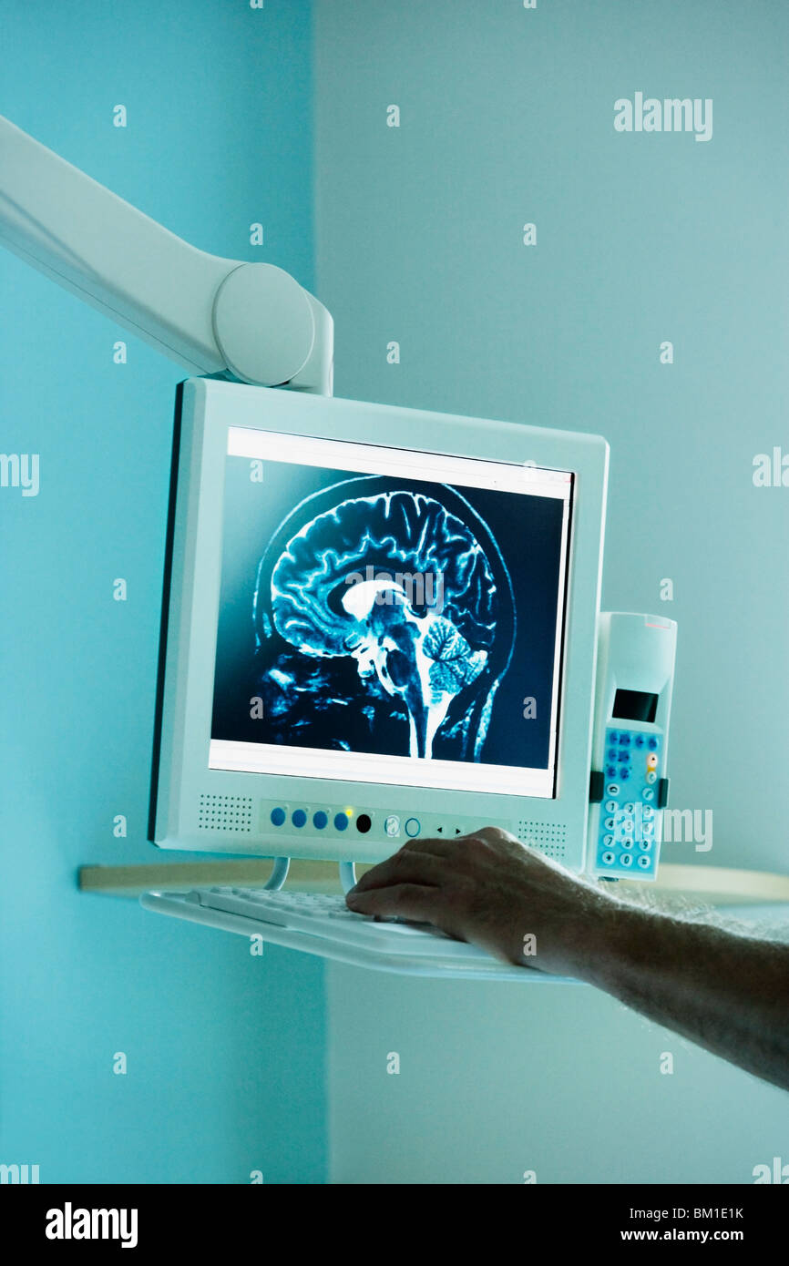 Doctor examining MRI scan on a computer screen Stock Photo - Alamy