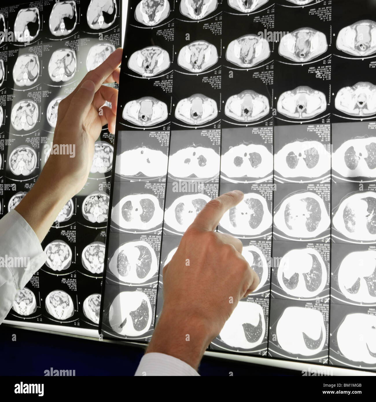 Doctor examining MRI report Stock Photo - Alamy
