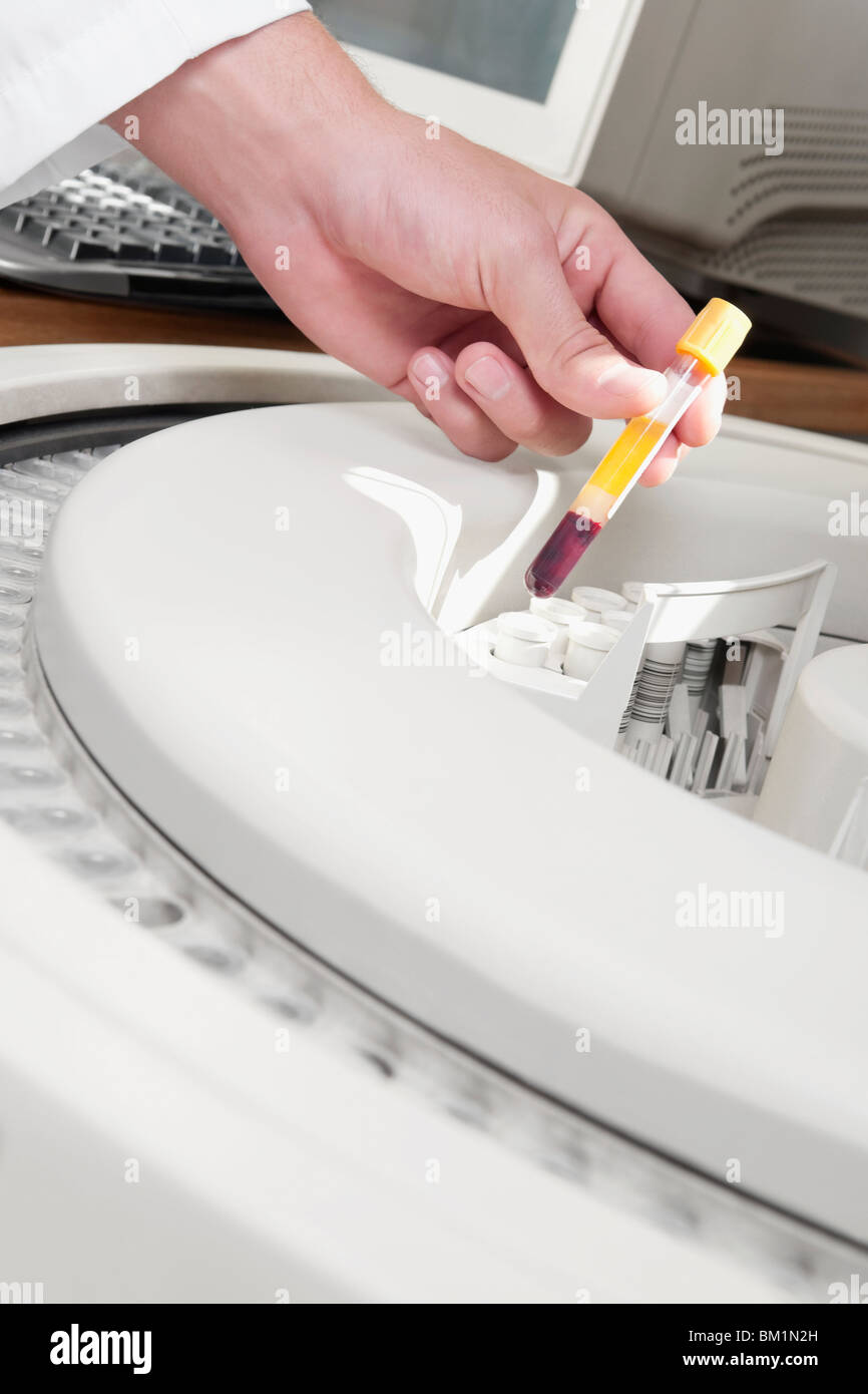 Lab technician putting a blood sample in the laboratory freezer Stock ...