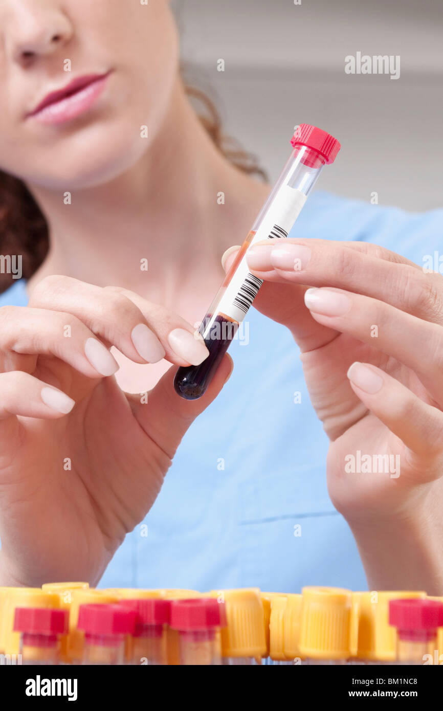 Female lab technician analyzing a blood sample in a test tube Stock ...