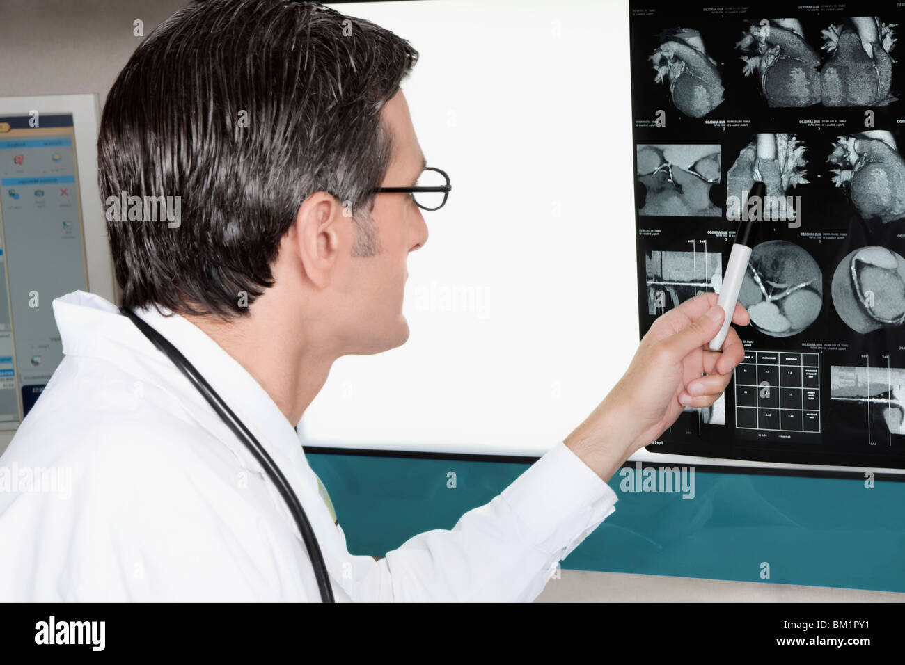 Doctor Examining Brain Cat Scan High Resolution Stock Photography and ...