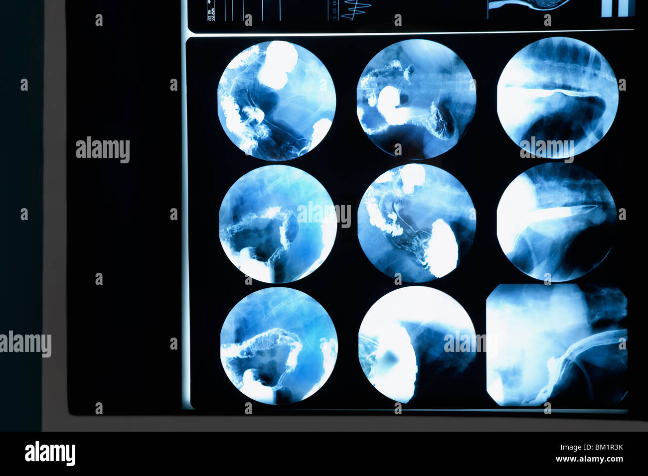 Close Up Of The Mri Scan Of The Human Brain High Resolution Stock Photography and Images - Alamy