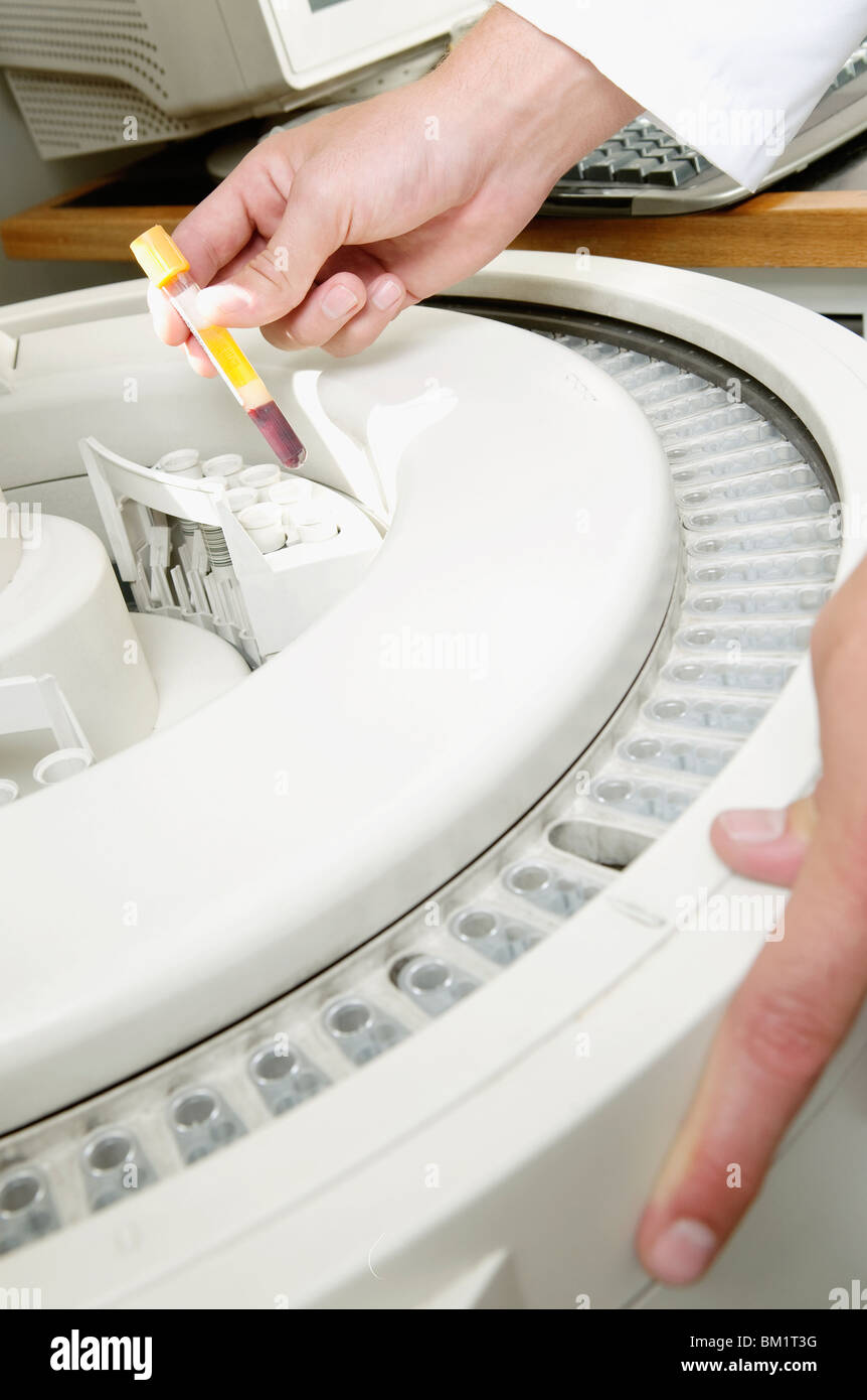 Lab technician putting blood sample in the laboratory freezer Stock ...