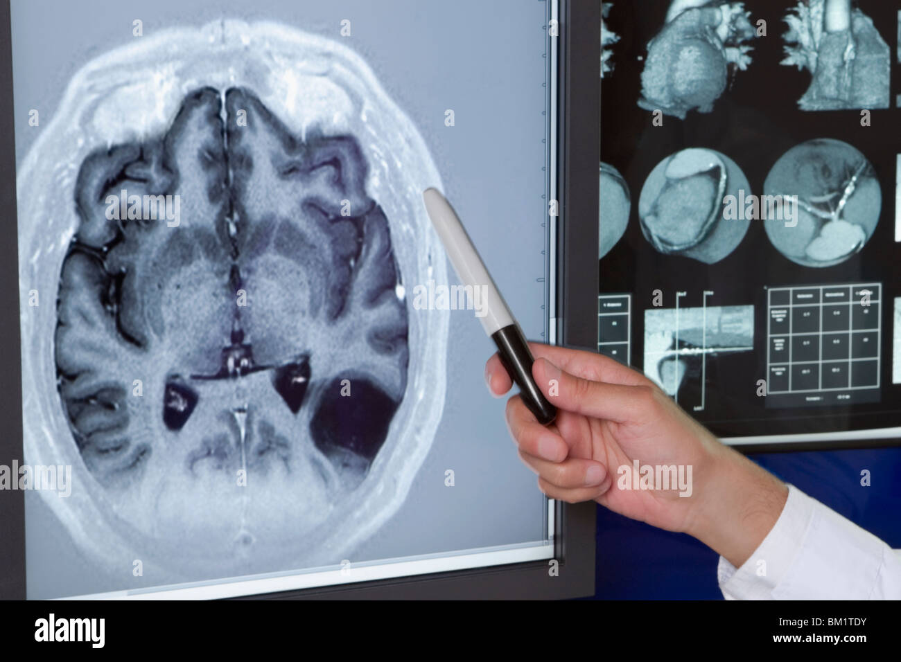 Mri report hi-res stock photography and images - Alamy