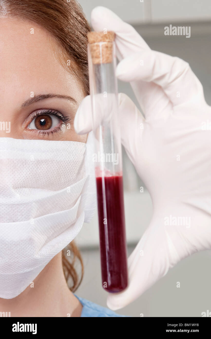 Blood sample hi-res stock photography and images - Alamy