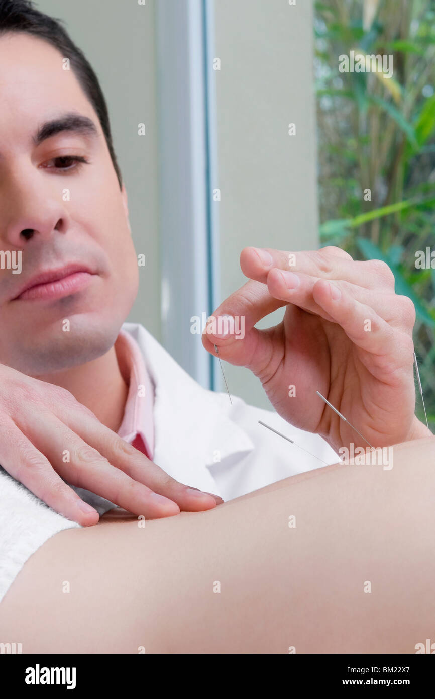 Applying acupuncture on skin hi-res stock photography and images - Alamy
