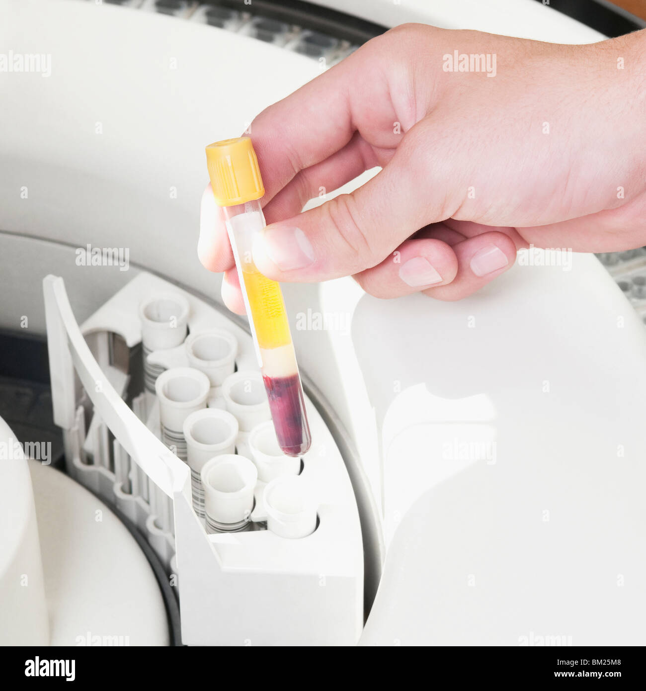 Lab technician putting blood sample hi-res stock photography and images ...