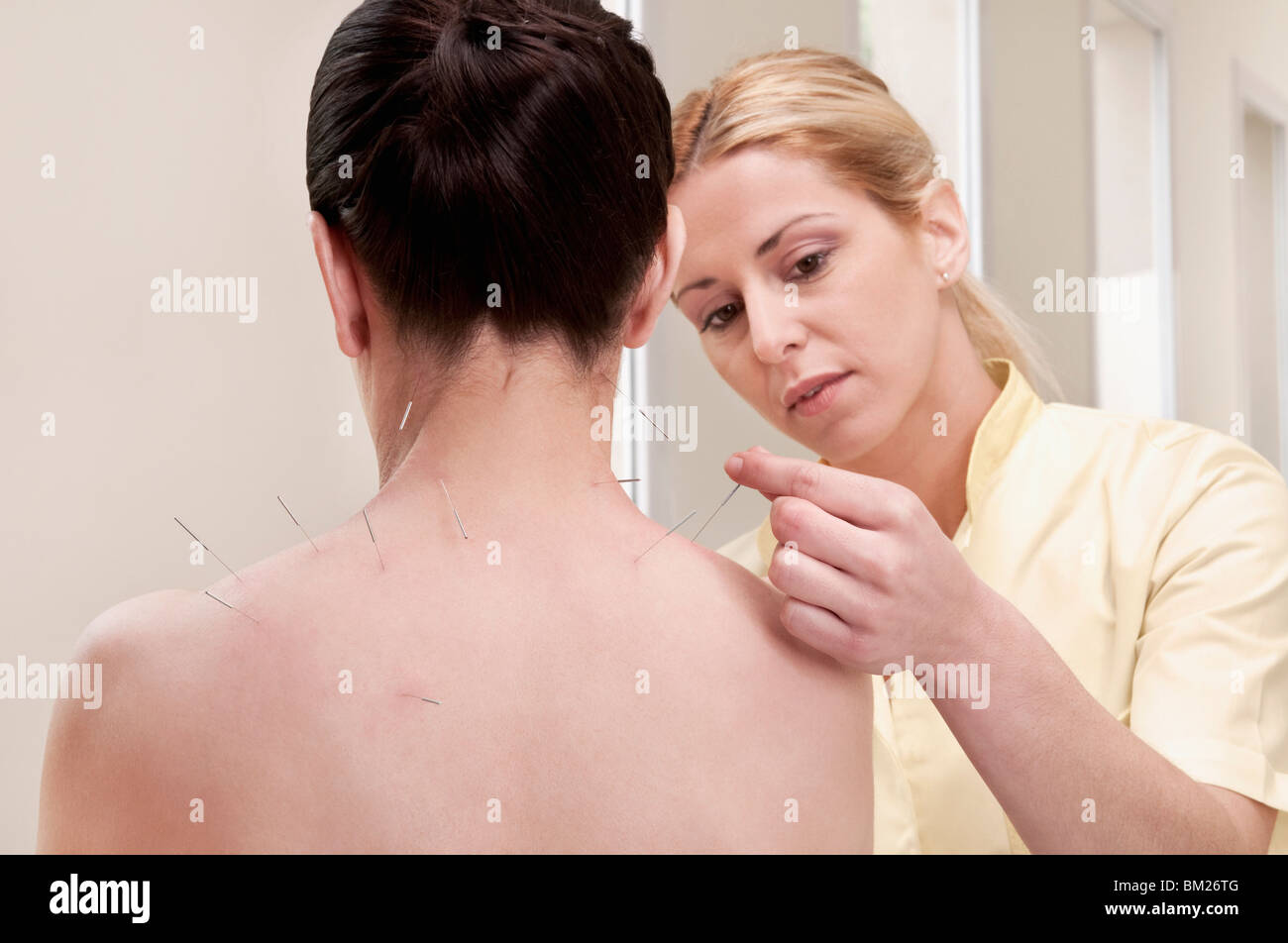 Acupuncturist hi-res stock photography and images - Alamy