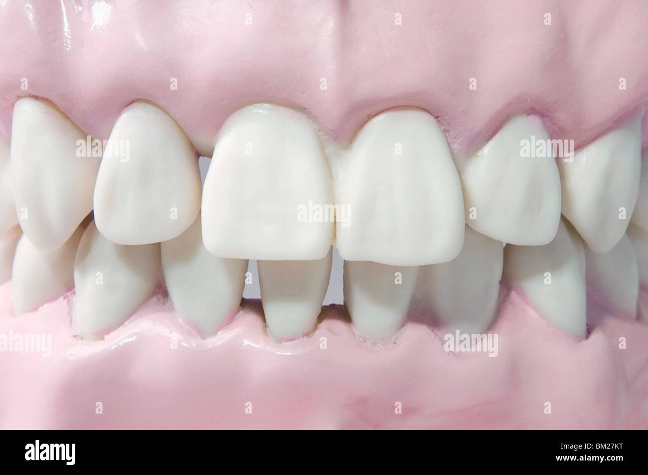 Full set human teeth hi-res stock photography and images - Alamy