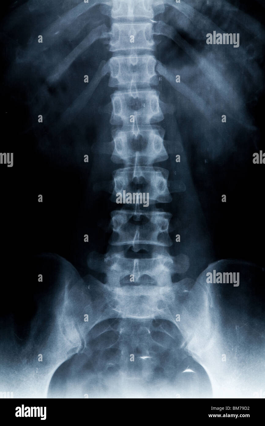 body x-ray photo for background Stock Photo - Alamy