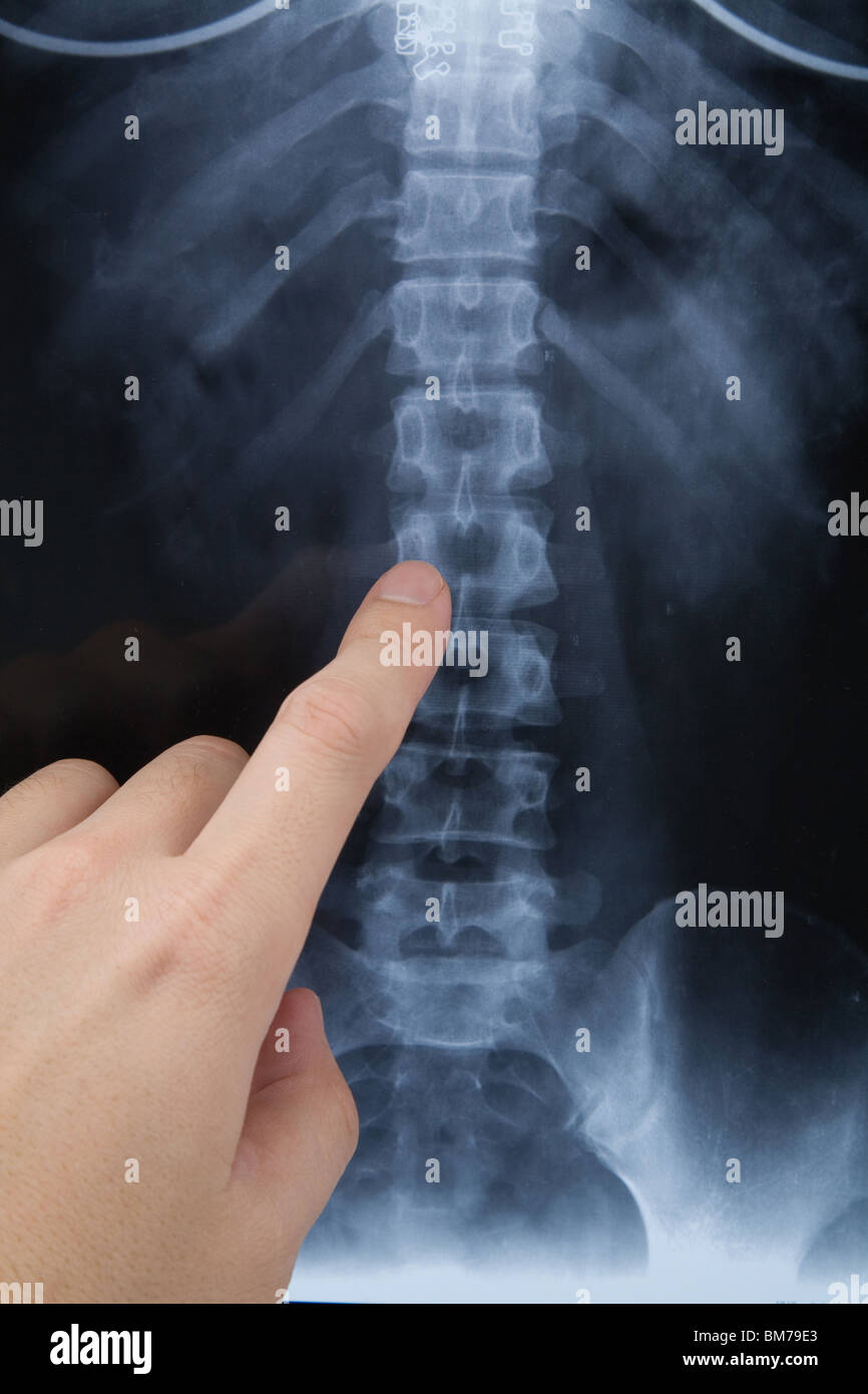 body x-ray photo for background Stock Photo - Alamy