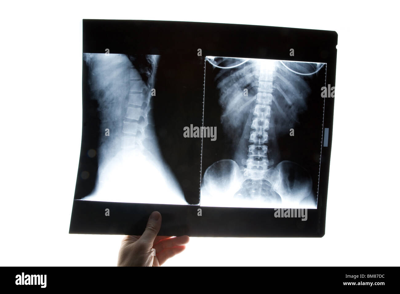 Medical ray spine body Cut Out Stock Images & Pictures - Alamy