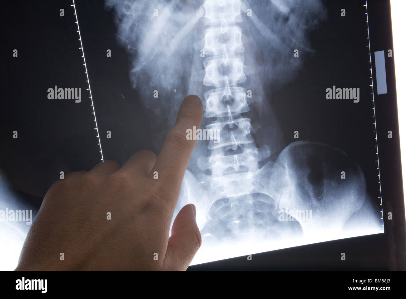 body x-ray photo for background Stock Photo - Alamy