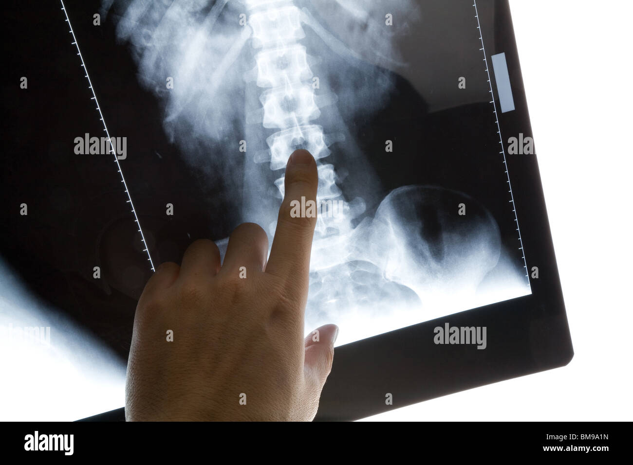 body x-ray photo for background Stock Photo - Alamy