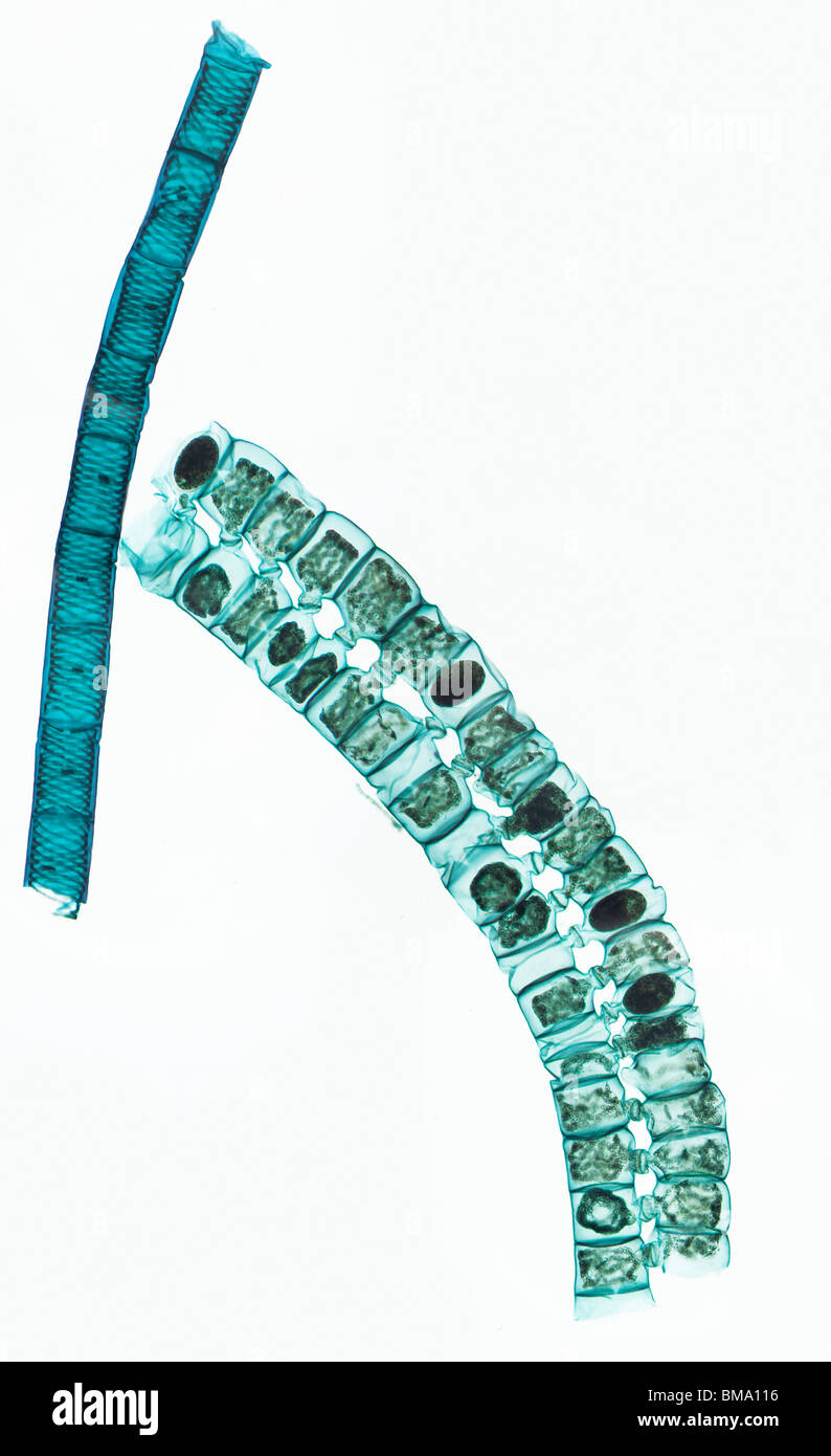 Spirogyra Under Compound Microscope