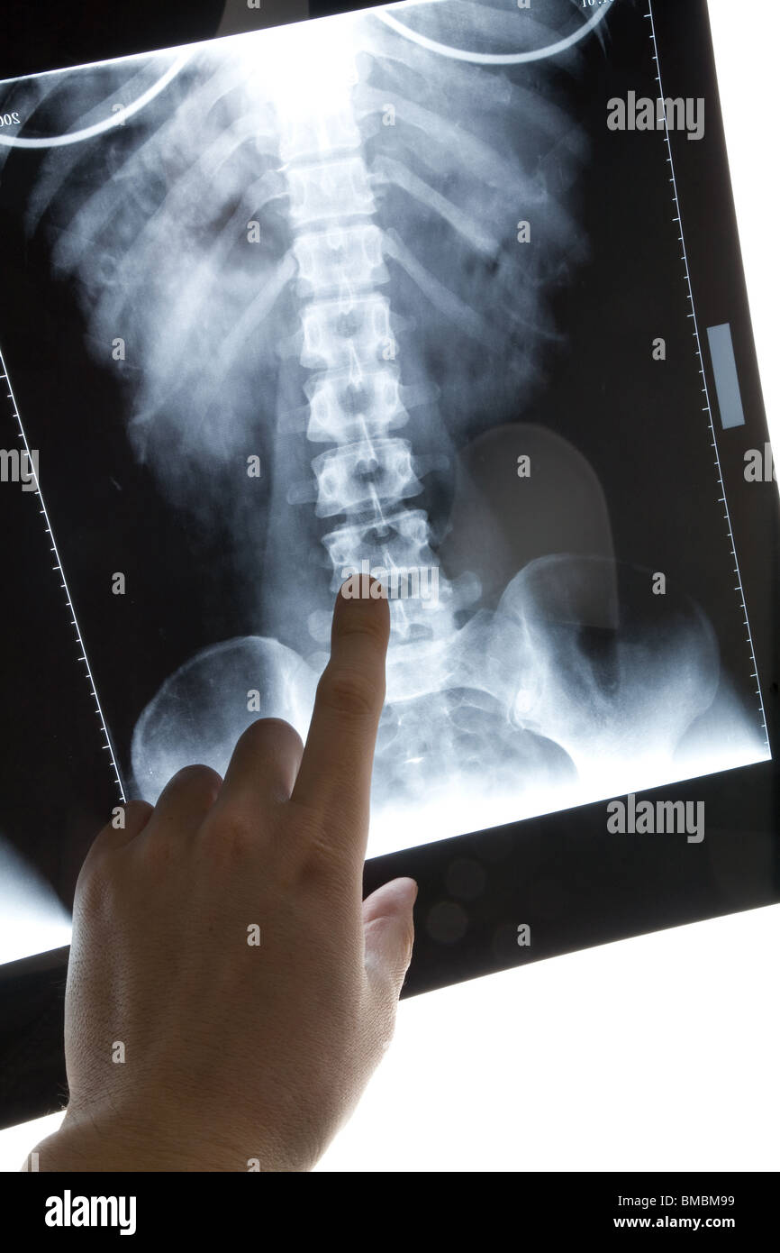 body x-ray photo for background Stock Photo - Alamy