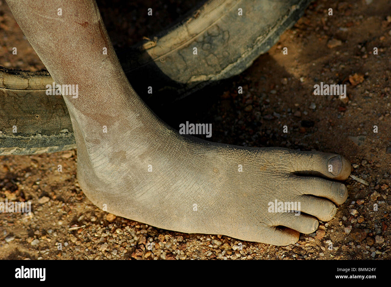 Niger, Niamey, Dusty foot of an african child Stock Photo - Alamy