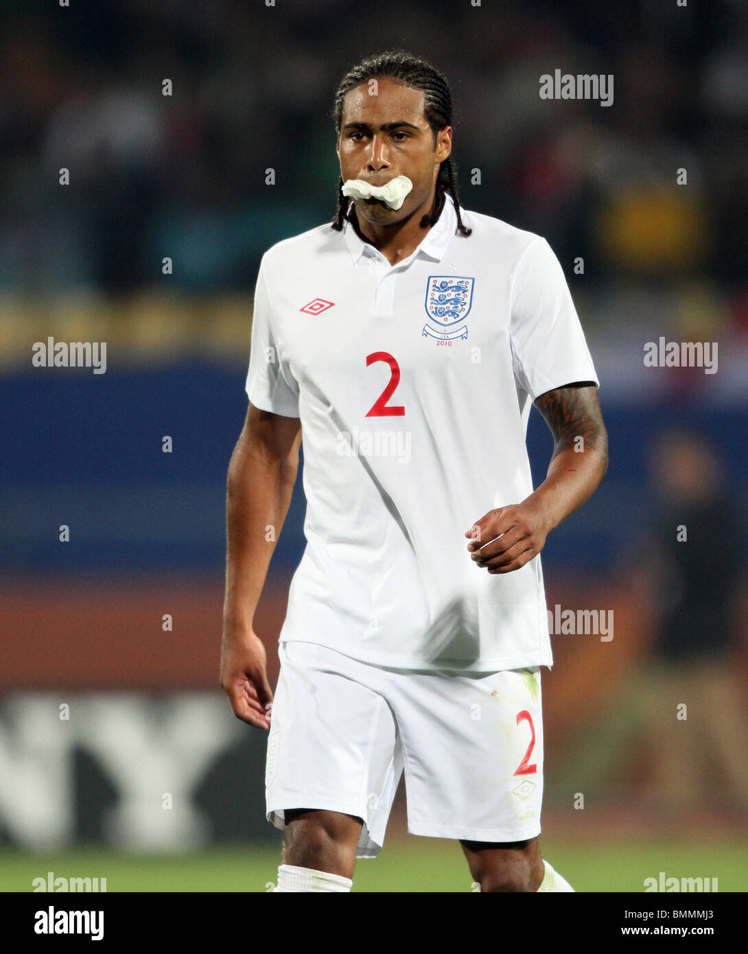 Split lip hi-res stock photography and images - Alamy