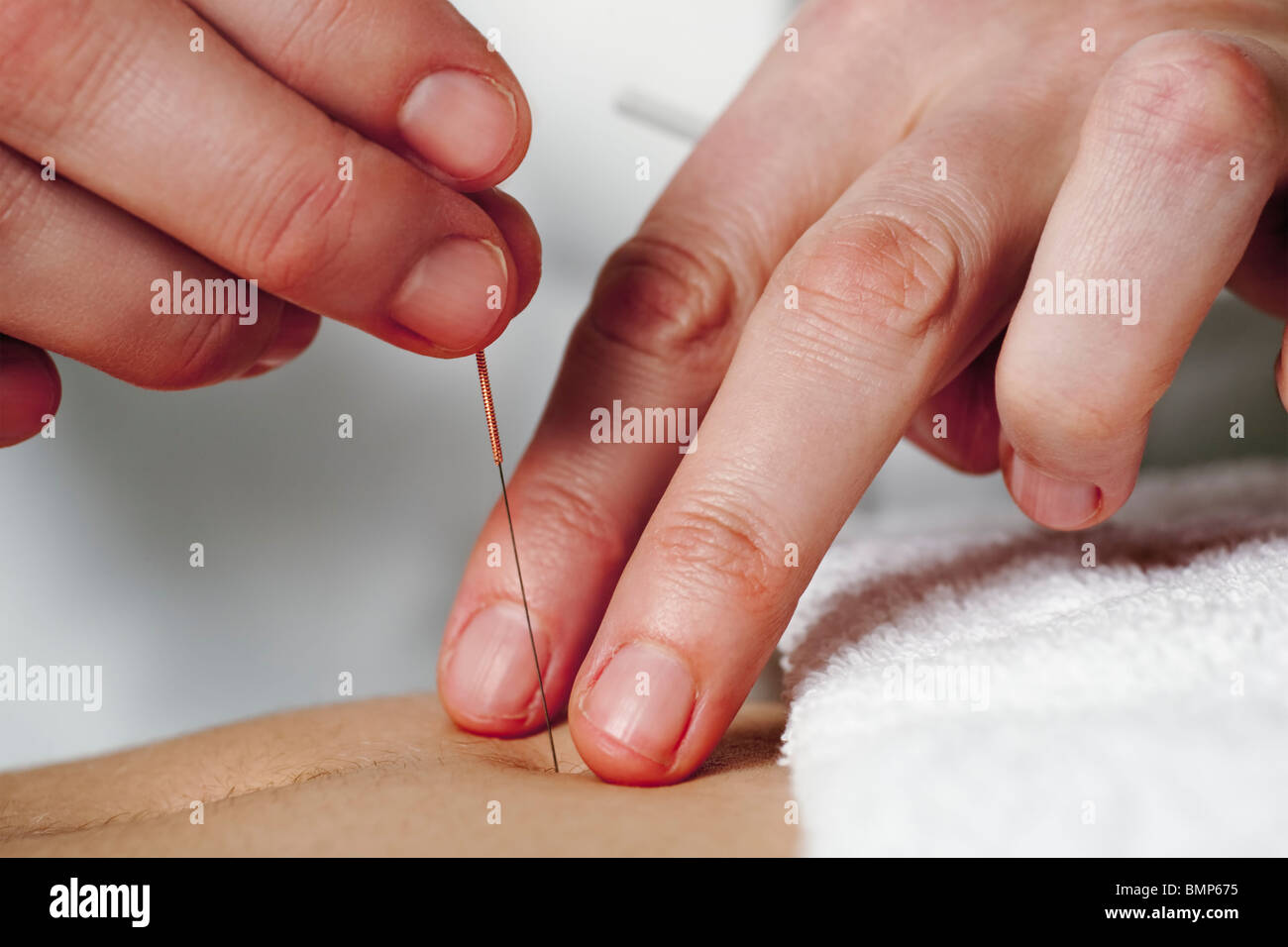 Acupuncture and hands hi-res stock photography and images - Alamy