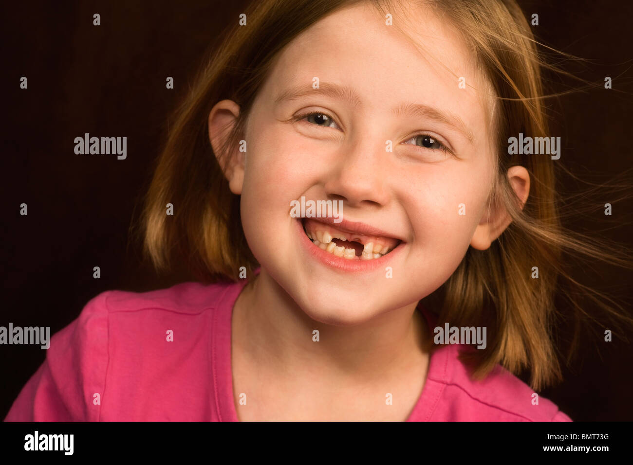 A Girl Smiling With Many Of Her Front Teeth Missing Stock Photo - Alamy