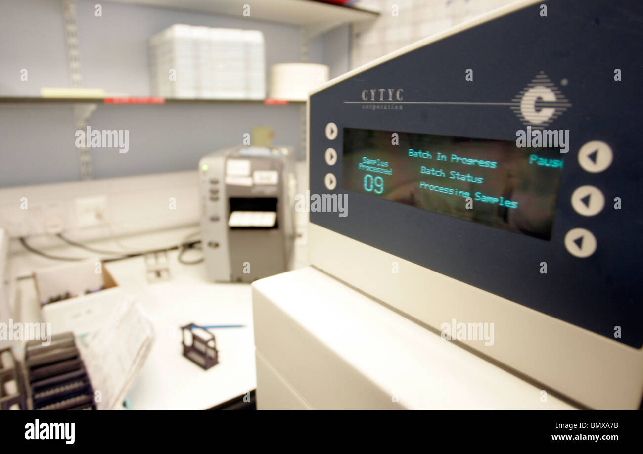 cevical screening service at northwick park middx Stock Photo - Alamy