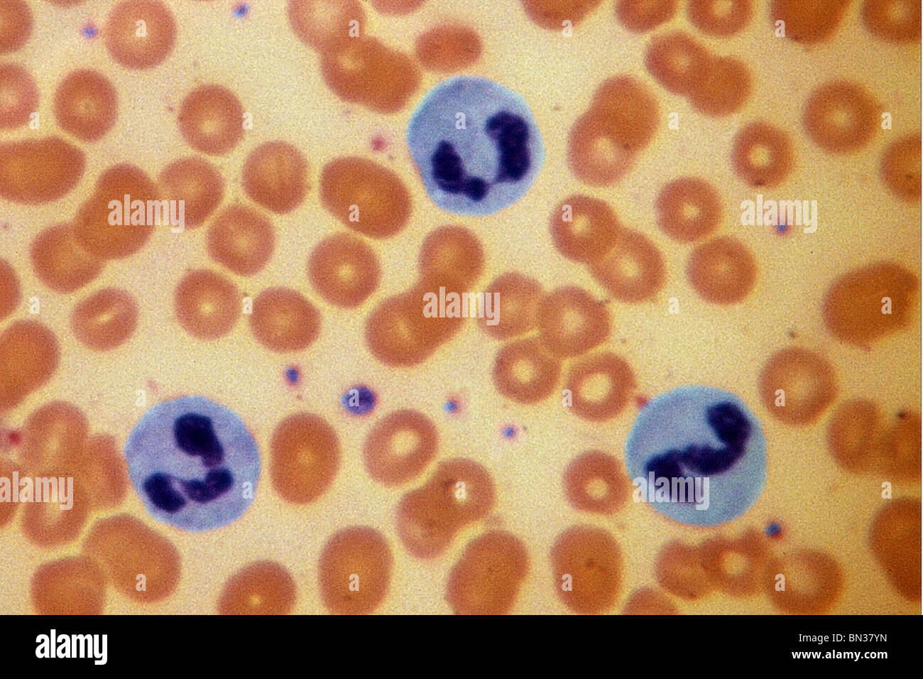 Blood smear micrograph hi-res stock photography and images - Alamy