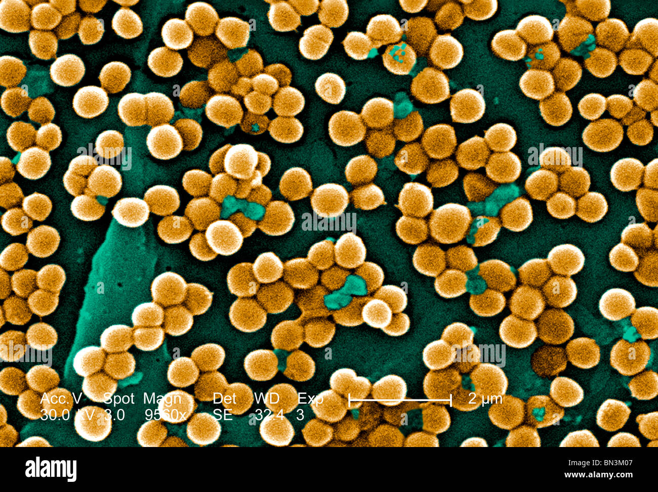 Staph Aureus High Resolution Stock Photography and Images - Alamy