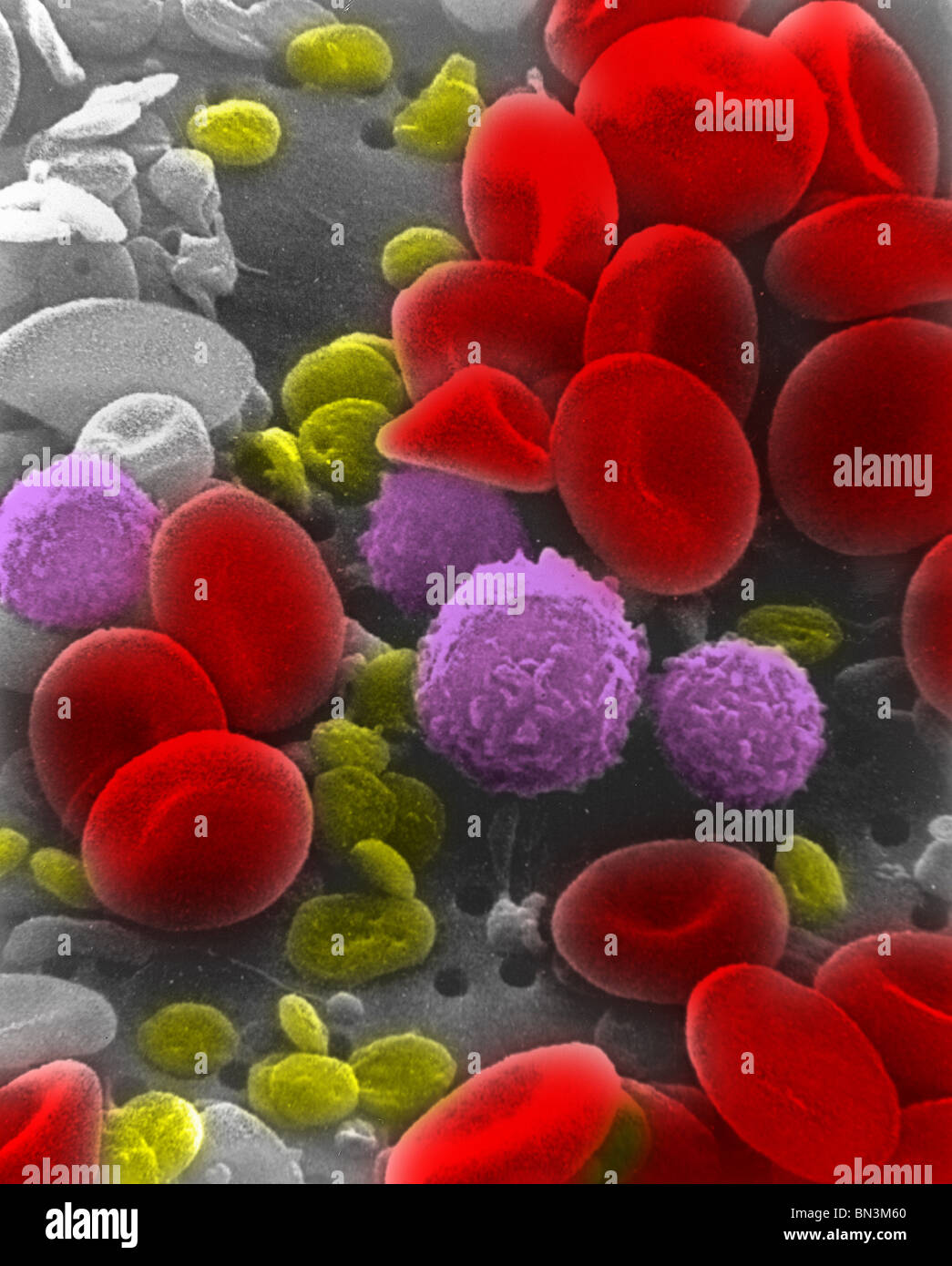 colorized scanning electron micrograph of human blood cells Stock Photo ...