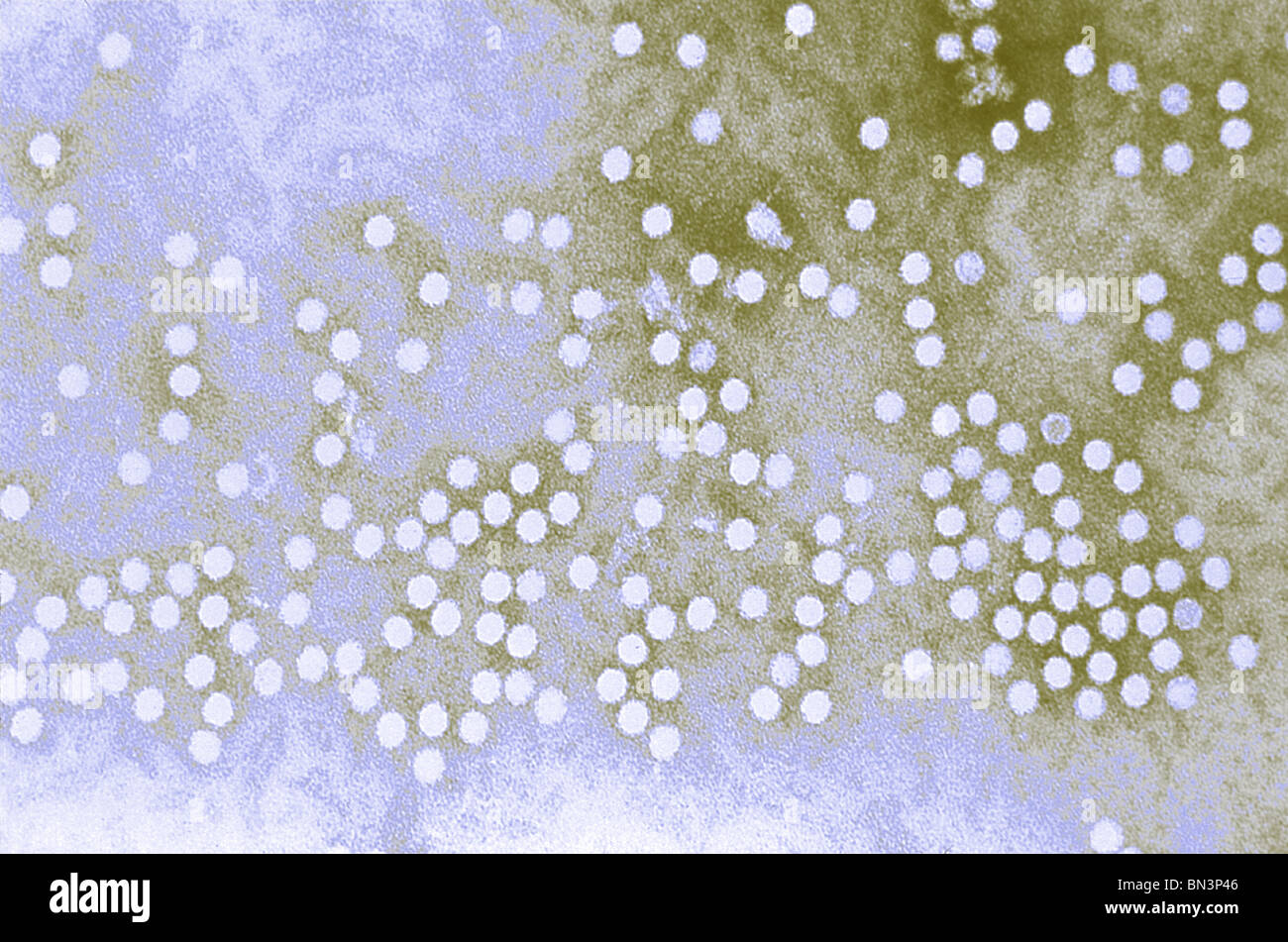 Negatively stained electron micrograph of Parvovirus H-1 virions of the ...