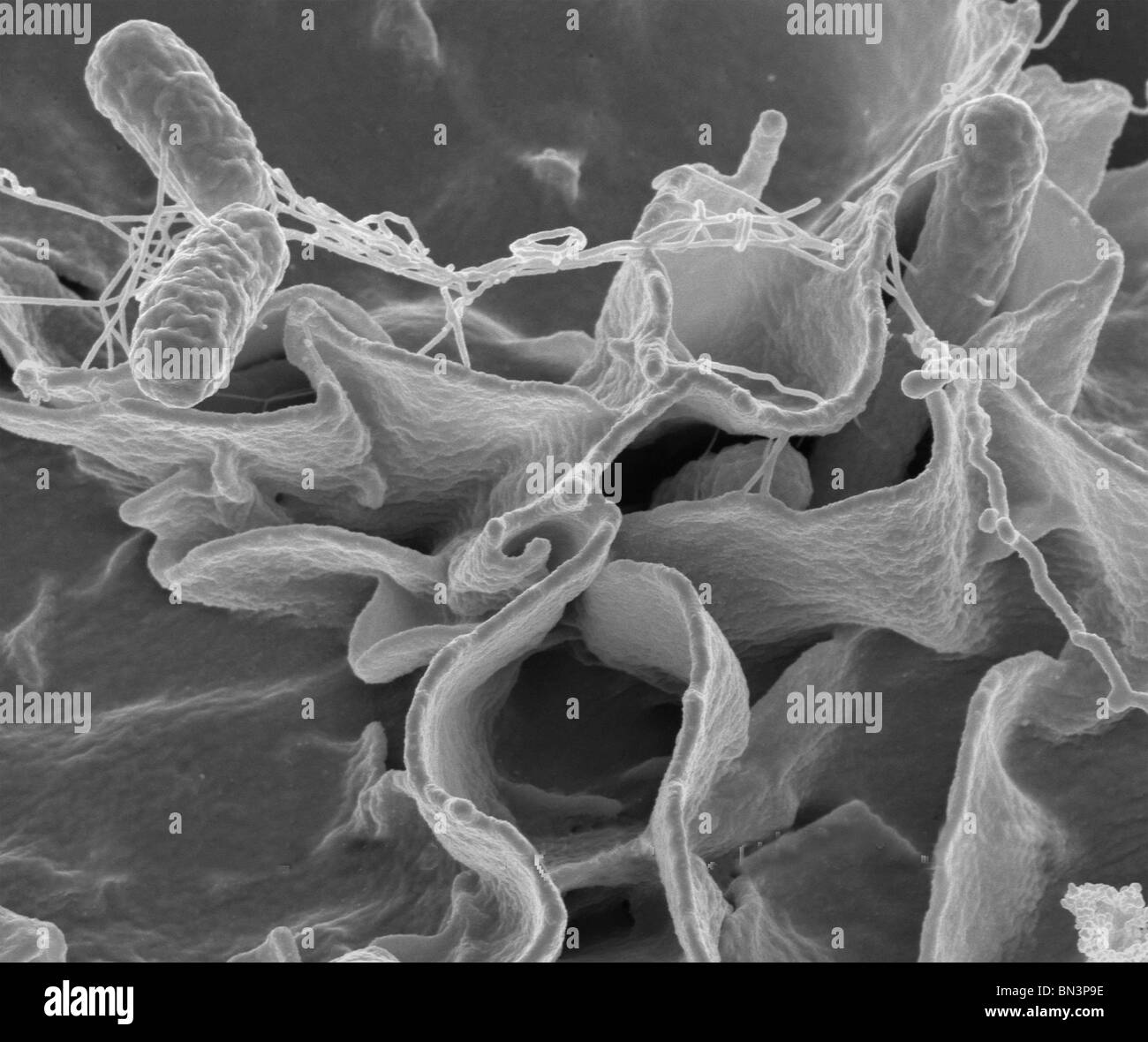 Scanning electron micrograph showing Salmonella typhimurium invading ... Scanning electron micrograph showing Salmonella typhimurium invading ...