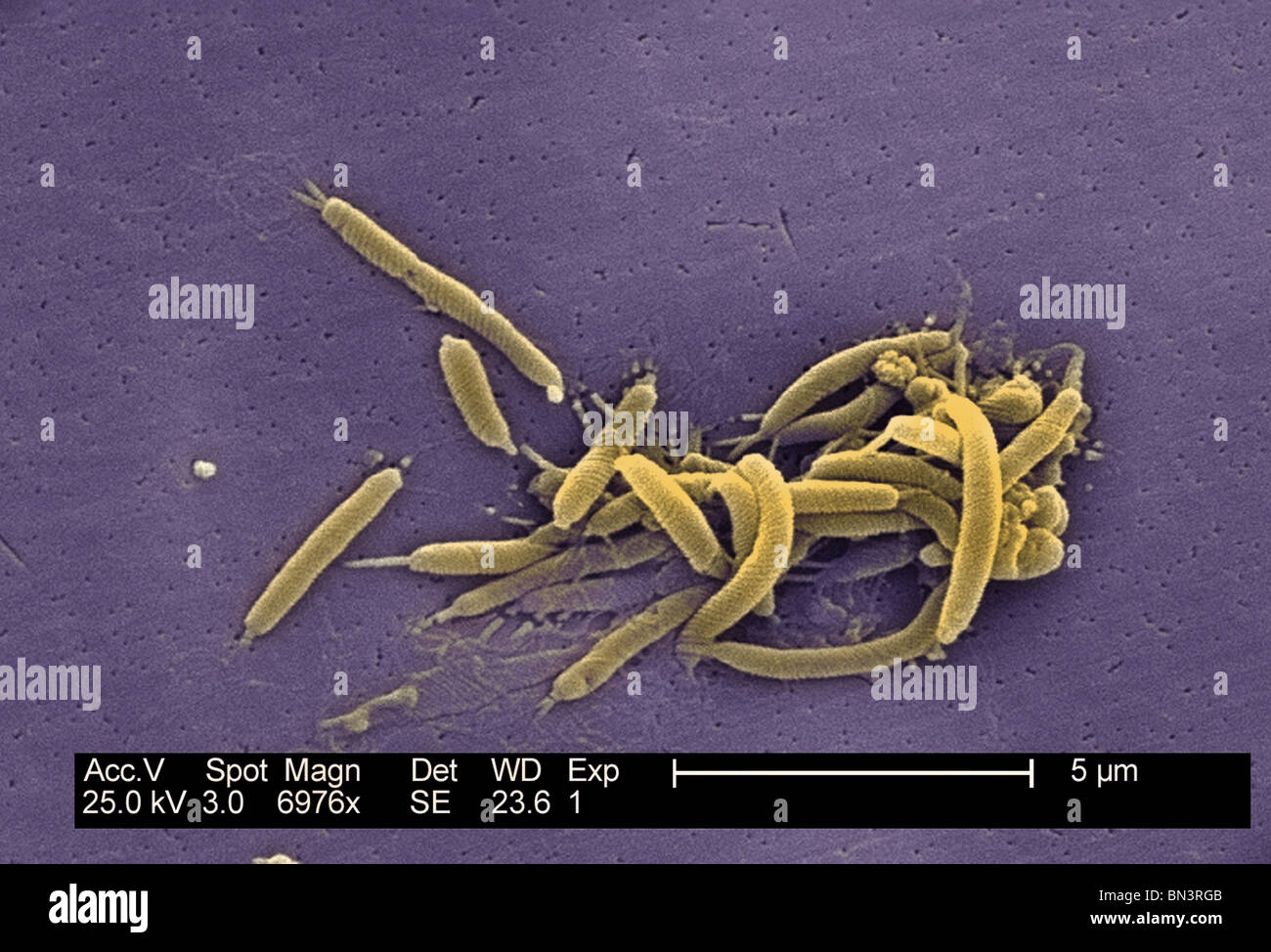 Bacteria flagella micrograph hi-res stock photography and images - Alamy