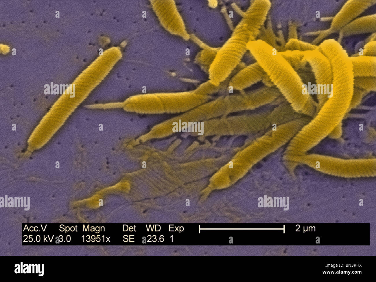 Magnified Bacteria Stock Photos & Magnified Bacteria Stock Images - Alamy