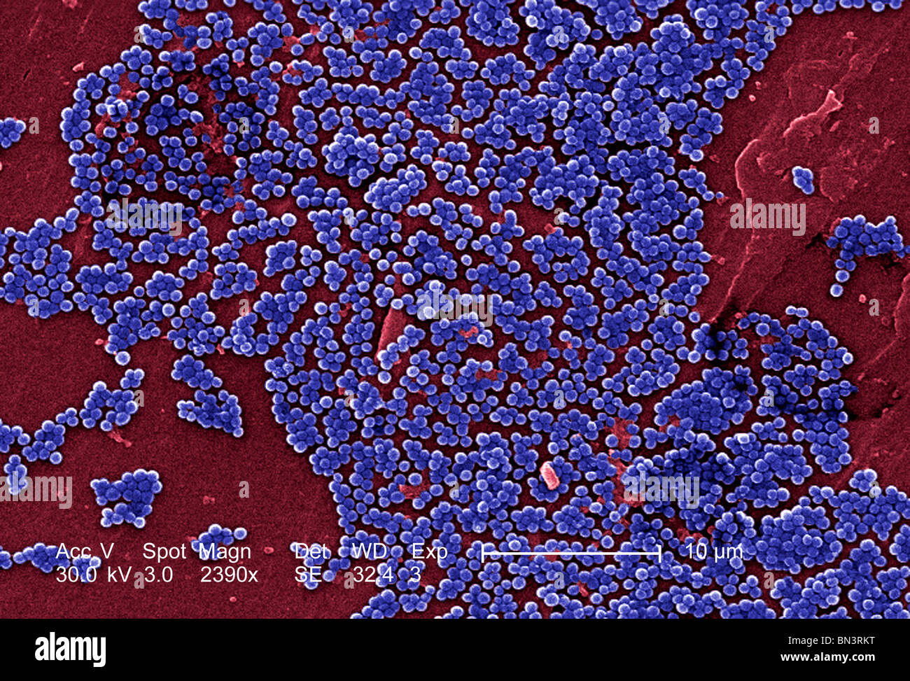 Scanning Electron Micrograph (SEM) of methicillin-resistant ...