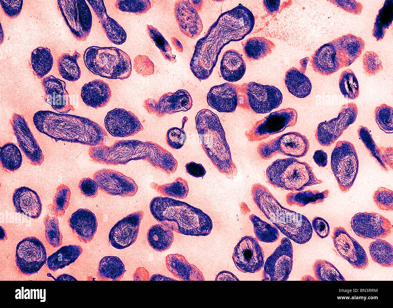 Transmission Electron Microscope Images Bacteria Micropedia