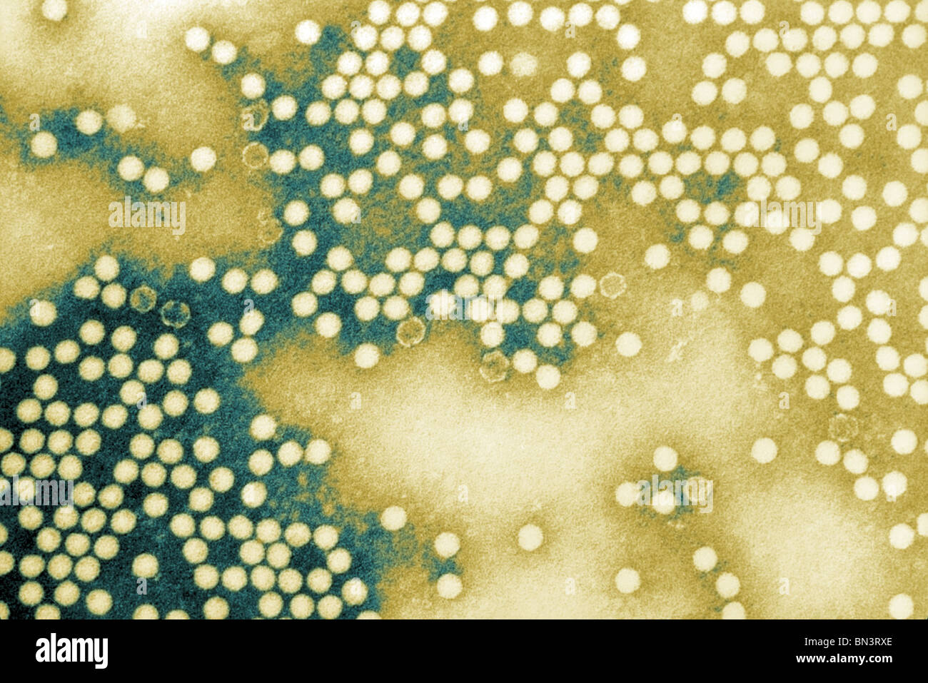 Transmission electron micrograph (TEM) of poliovirus type 1 seen with ...