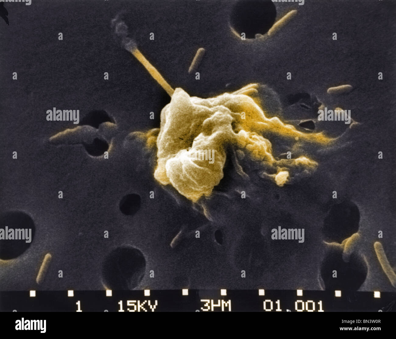 SEM of the Death of a Cancer Cell (6 step sequence Stock Photo - Alamy