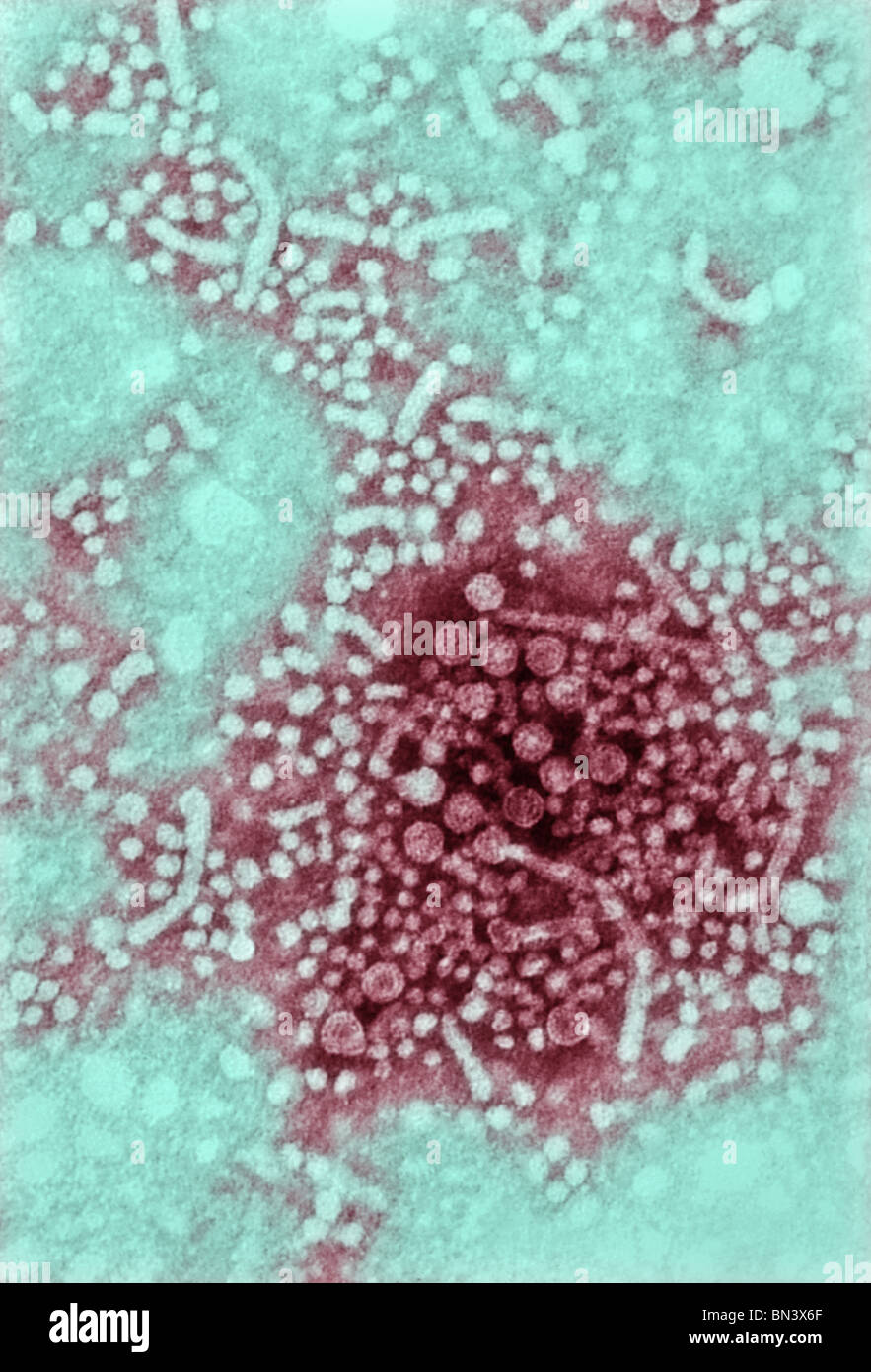 Colorized negatively-stained transmission electron micrograph (TEM) of ...