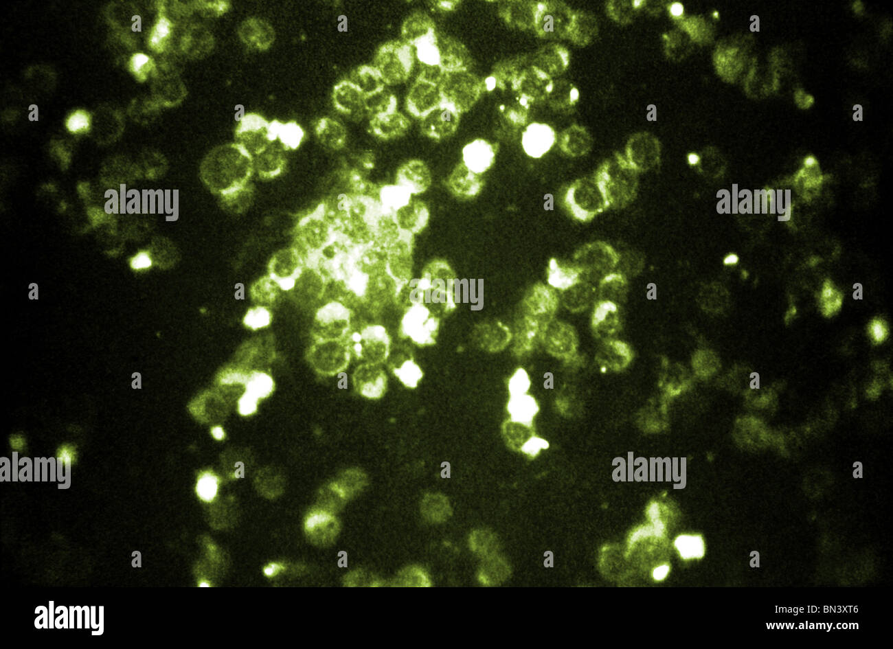 Photomicrograph showing respiratory syncytial virus (RSV) using ...