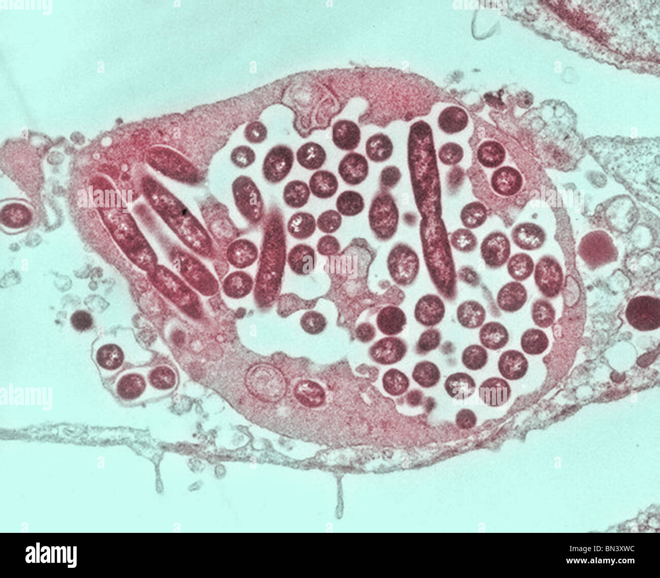 Transmission electron micrograph showing Legionella pneumophila ... Transmission electron micrograph showing Legionella pneumophila ...