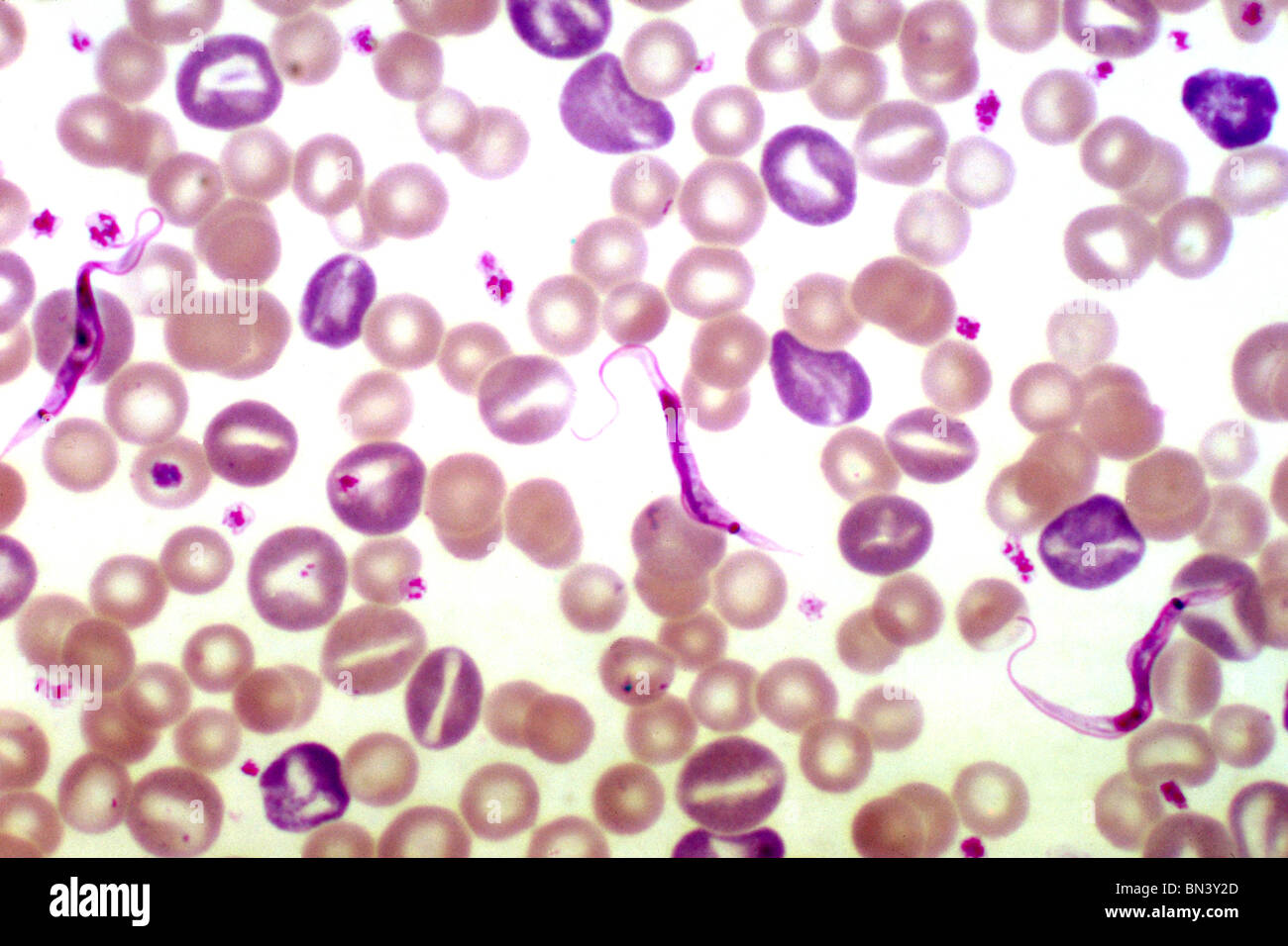 Blood smear High Resolution Stock Photography and Images - Alamy