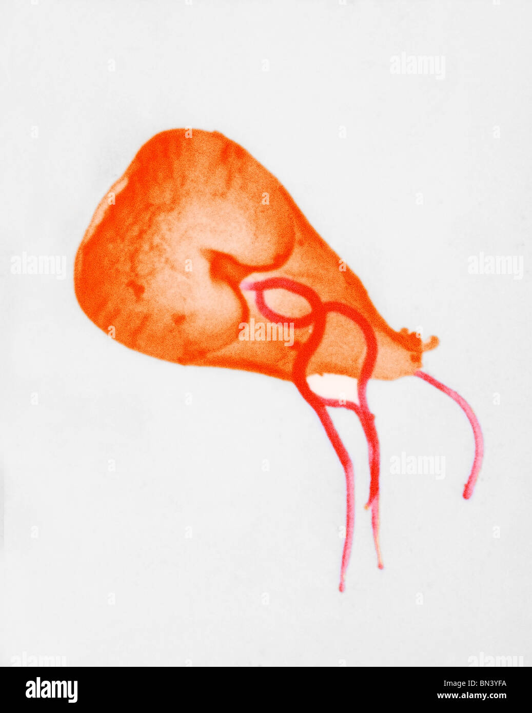 Scanning electron micrograph (SEM) of a flagellated Giardia lamblia ...